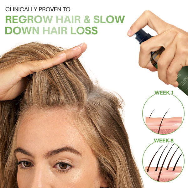 Spray pousse cheveux au Magnesium – Offrego